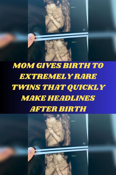 Mom Gives Birth To Extremely Rare Twins That Quickly Make Headlines