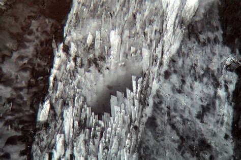 Cholesterol Crystals Under The Microscope Adipose Body Cholesterol Photo Background And Picture