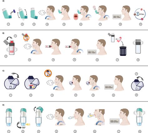 Full Article Characteristics Of Inhaler Technique In Copd Patients In