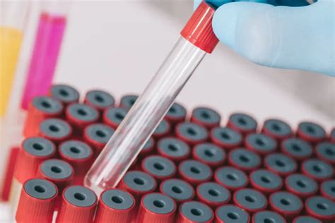 Storage Guidelines For Biological Specimens Duration And Conditions Storage Guidelines For Biological Specimens Duration And Conditions