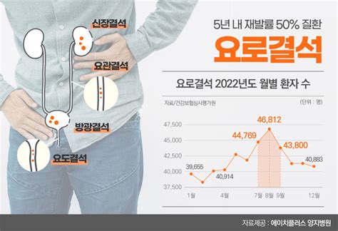 요로결석이 자주 생기는 이유는 무엇인가요