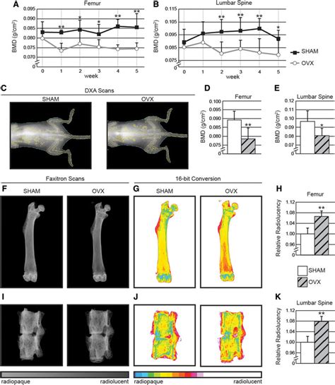 Dxa Scans Of A Distal Femur And B Lumbar Spine Exhibit A