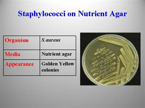 Pht 313 Lab 1 Staphylococci Bacteria Grams Stain
