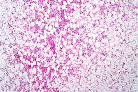 Human Bone Marrow Under The Light Microscope View Stock Image Image Of Healthcare Feminine