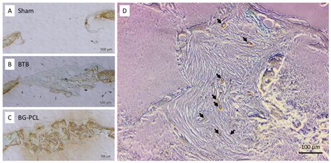 Figure 2 From Bioactive Glass Polycaprolactone Hybrid With A Dual Cortical Trabecular Structure