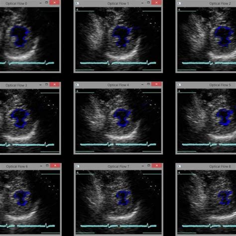 Lucas Kanade Optical Flow Estimation Download Scientific Diagram
