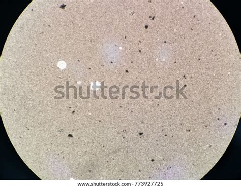 2개의 Cryptococcus Spp 이미지 스톡 사진 3d 오브젝트 벡터 Shutterstock