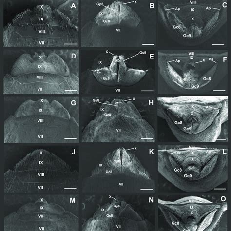 Female External Genitalia Examined By Scanning Electron Microscopy Download Scientific Diagram