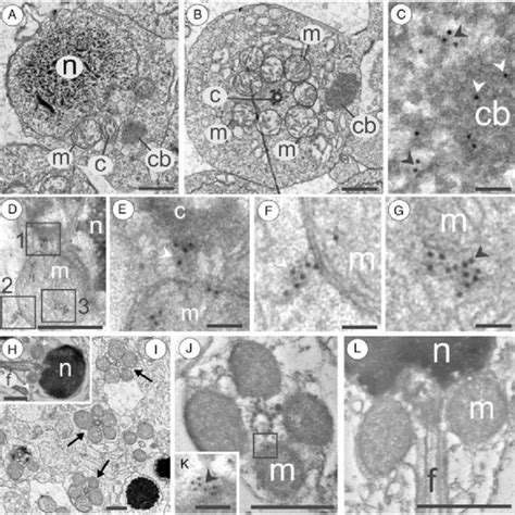 Diplotene Diplotene Begins After The Repair Of The Dsbs With The Download Scientific Diagram