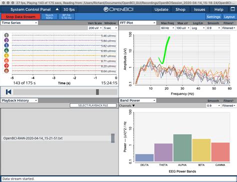 Expected Impedance Range With Ultracortex Cyton Resolved OpenBCI Forum