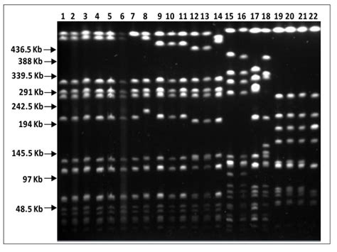Smai Macrorestriction Profiles Of S Aureus Clinical Isolates Numbers