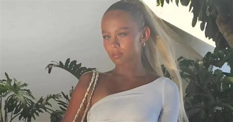 Model Who Embraced Lazy Eye Is Now Spending 4k To Fix It Before She Loses Sight Daily Star