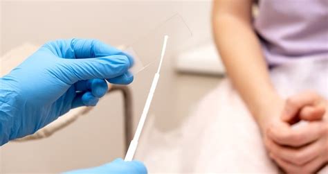 How To Swab For Gonorrhea And Chlamydia Puritan Medical Products
