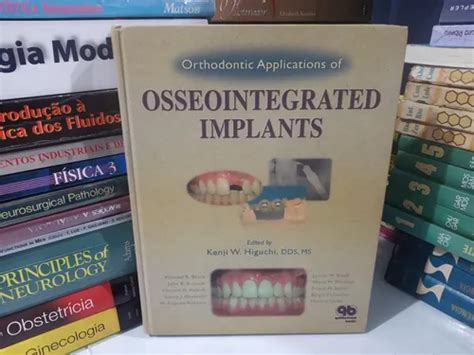 Orthodontic Applications Of Osseointegrated Implants Parcelamento Sem Juros