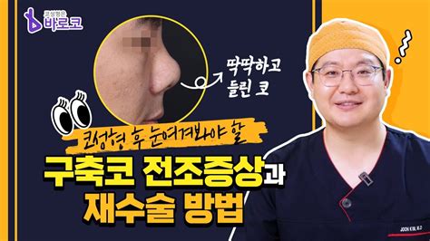코성형 부작용 구축코 전조증상은 구축코 원인과 재수술 방법까지 파헤쳐봐요🔍 Youtube