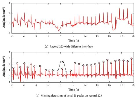 an adaptive and time efficient ecg r peak detection algorithm pmc