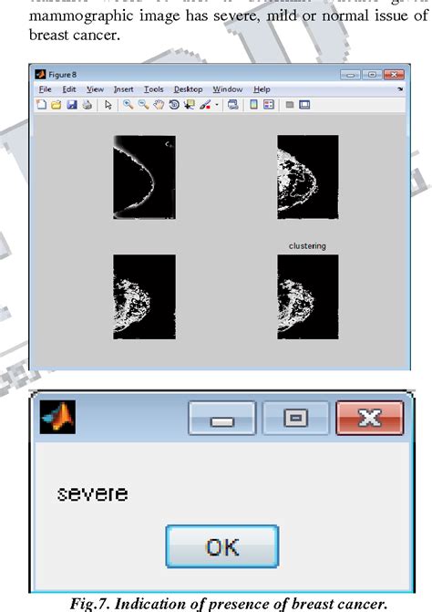 Figure 5 From Classification Of Local Binary Patterns In Mammogram Using Svm Semantic Scholar