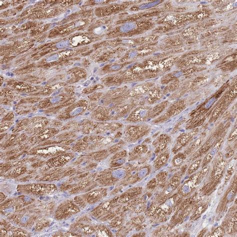Rabbit Polyclonal Anti Pdha1 Antibody Buy For Research Highly