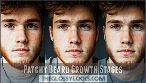 Patchy Beard Styles For Teens 10 Cool Looks That Work With Uneven Growth