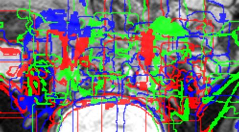 How To Get Slic Visualisation Using Simpleitk Slicimagefilter
