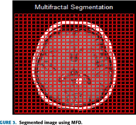 Figure 1 From Neural Network Based Brain Tumor Detection Using Wireless