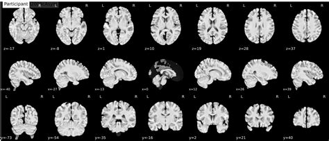 Issue With Fmriprep Brain Segmentation Software Support Neurostars