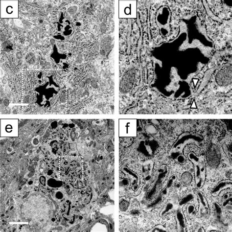 Electron Microscopic Analysis Of Avp Neurons In 5 Month Old Fndi Mice