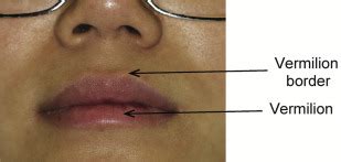Clinical Evaluation And Anatomic Variation Of The Oral Cavity