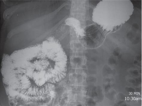2 Stomach And Duodenum Abdominal Key