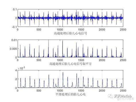 【心电信号ecg】基于nlms算法实现孕妇胎儿心电信号提取附matlab代码 matlab仿真博客的技术博客 51cto博客