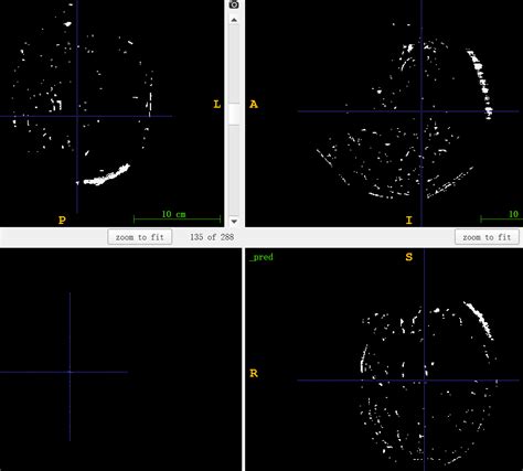 Acenet Issues · Issue 1 · Ymli39acenet For Neuroanatomy Segmentation · Github