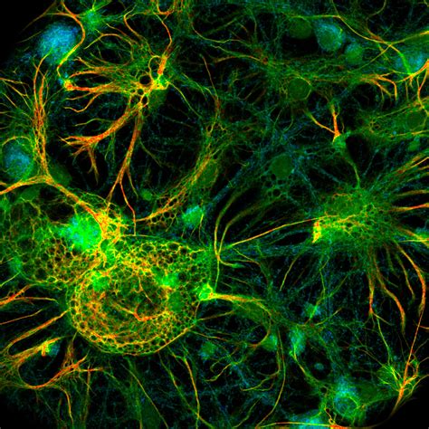 Luminosa Explore New Paths In Confocal Microscopy Picoquant