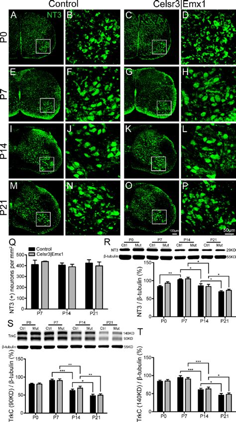 Expression Of Nt 3 And Trkc Nt 3 Immunoreactivity Is Widely