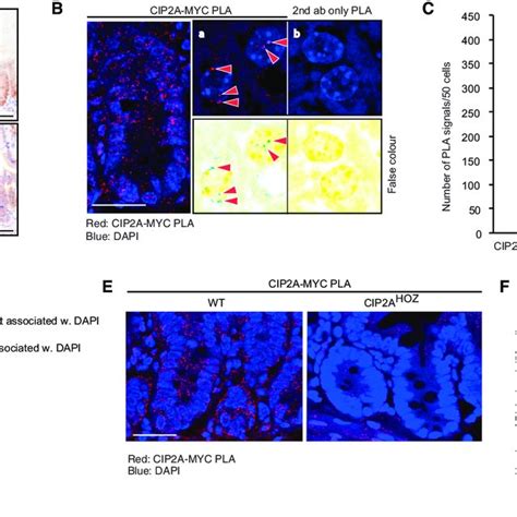 Cip2a Interacts With Myc In Intestinal Tissue A Immunohistochemical