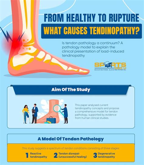 Sports Med U On Linkedin From Healthy To Rupture What Is The