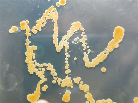 Staphylococcus News Articles Iflscience