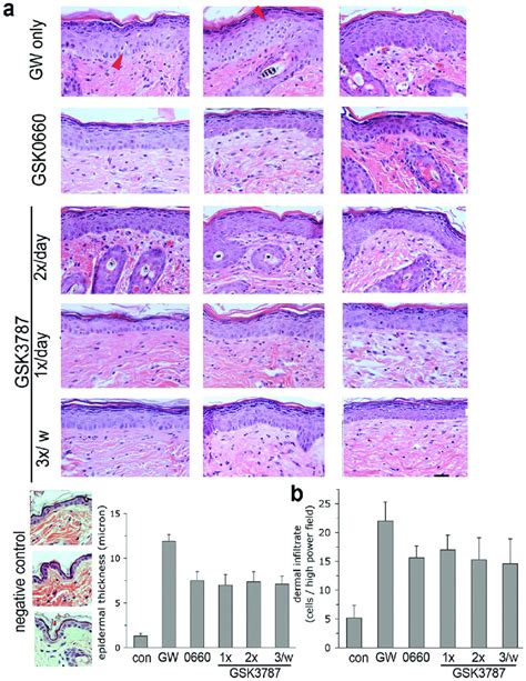 Control Of Ppar Bd Mediated Skin Disease Using Reduced Frequency
