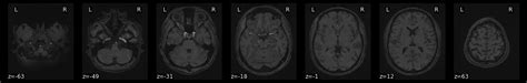 Introduction To Neuroimaging Data Naturalistic Data Analysis