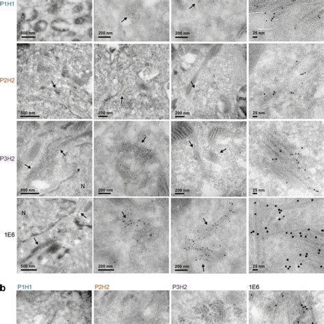 Identification Of Hev Induced Vesicular And Tubular Structures In