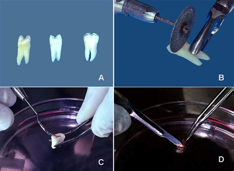 Isolation Culture And Characterization Of Dental Pulp Stem Cells From Human Deciduous And