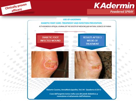 Kadermin Spray Scx Powder Silicium Dioxide Silver Ions