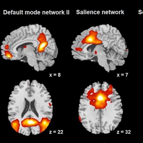Brain Systems Underlying The Emotional Stroop Task A The Emotional