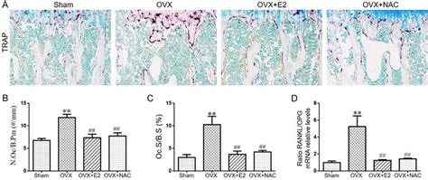 The Effect Of E2 Or Nac On The Osteoclastic Bone Resorption In Download Scientific Diagram