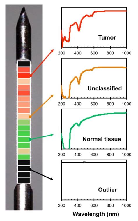 Example False Color Tissue Classification Results Displayed Along The