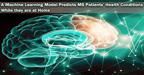 A Machine Learning Model Predicts Ms Patients Health Conditions While