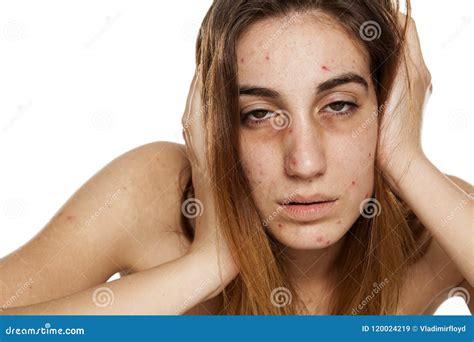 Drug Addict Woman Stock Image Image Of Irritation Addiction 120024219