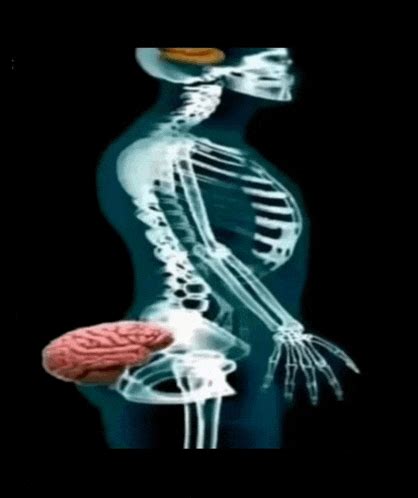 No Brain Dumb Meme No Brain Dumb Discover And Share S