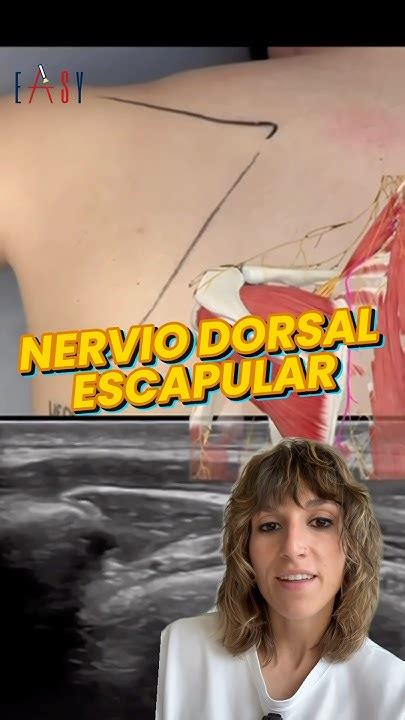 Ecografía Del Nervio Dorsal Escapular Youtube