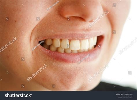 Human Smiles Teeth