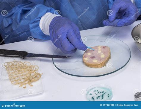 Expert Analyzes Stuffed Meat Contaminated By Bacterium Of Listeria In